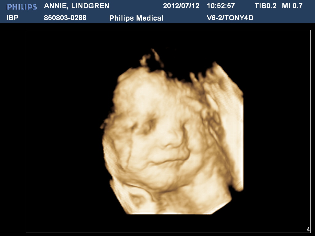 Nu syns jag i 3D! – Filip Alexander Julian I